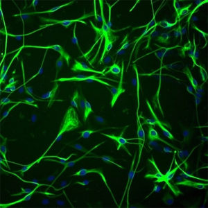 Immortalized Human Astrocytes – Cells Online