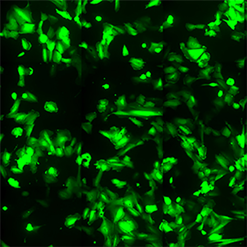 Immortalized Brain Microvascular Endothelial Cells Cells Online