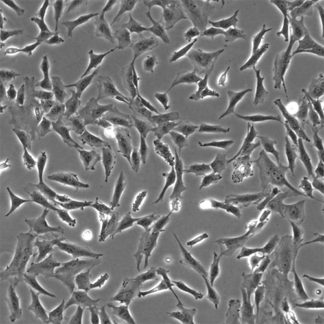 Human Retinal Astrocytes – Cells Online