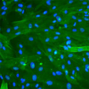 Green Fluorescent Human Pancreatic Stellate Cells – Cells Online