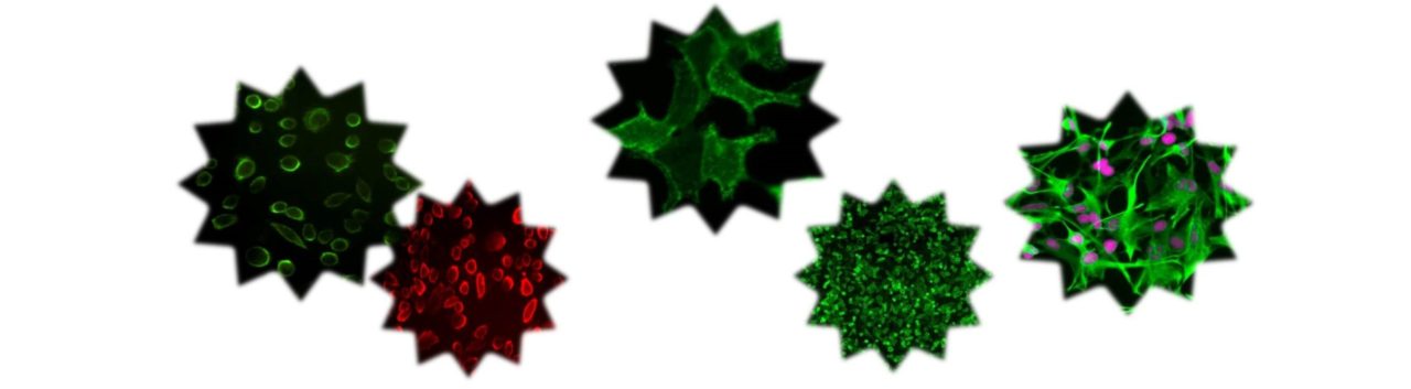 Cell Lines for Immune and Infectious Disease Research – Cells Online