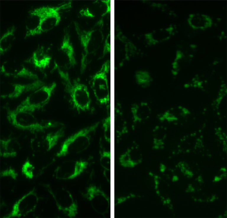 Fluorescent Mitochondria U2OS Cell Line – Cells Online