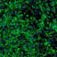 Human Gingival Epithelial Cells – Cells Online