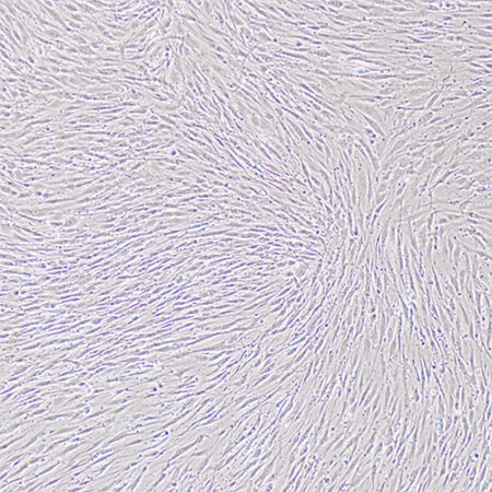 Human Tenocytes – Cells Online